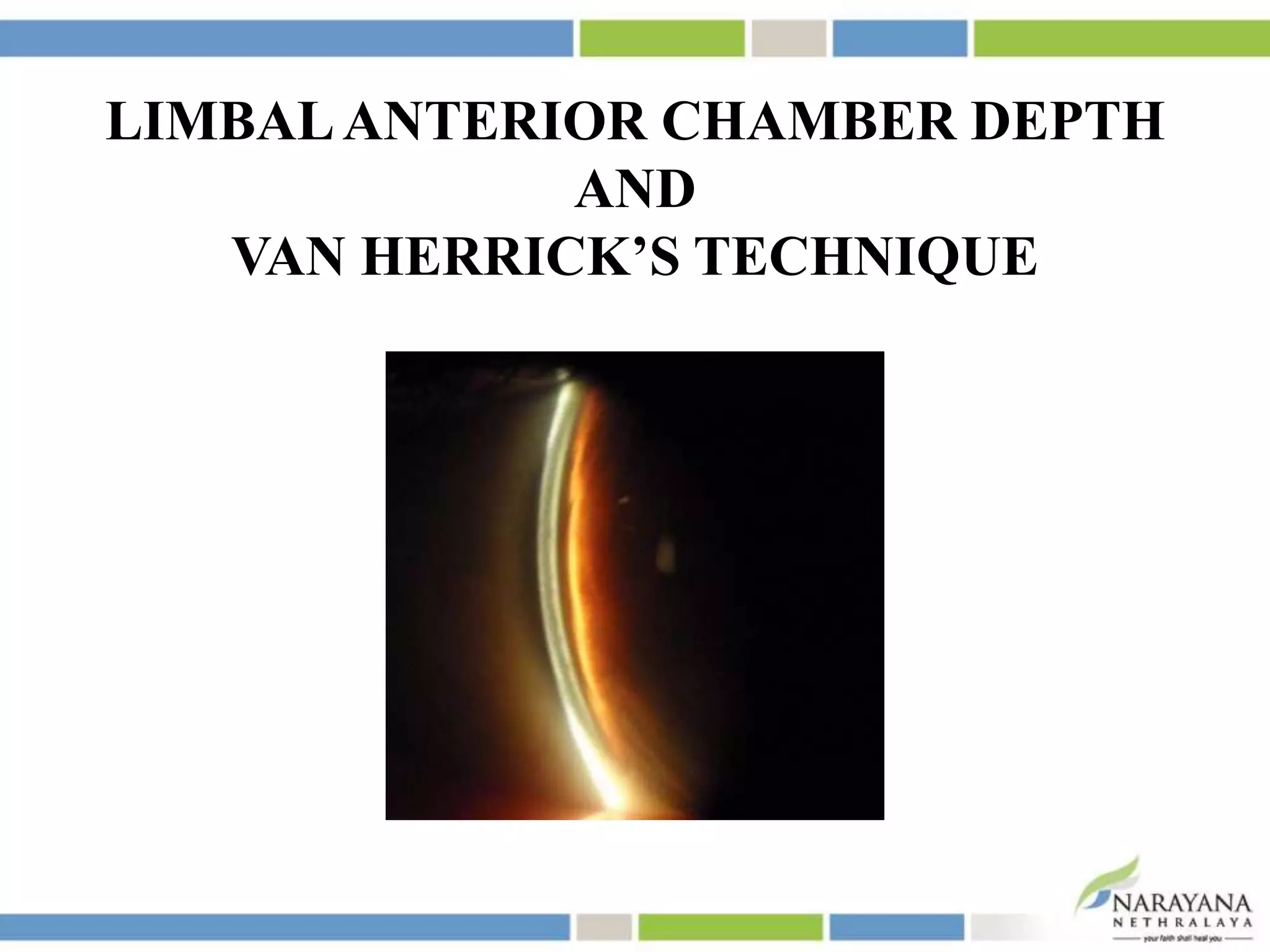 Assessment of Anterior Chamber Angle | PPTX
