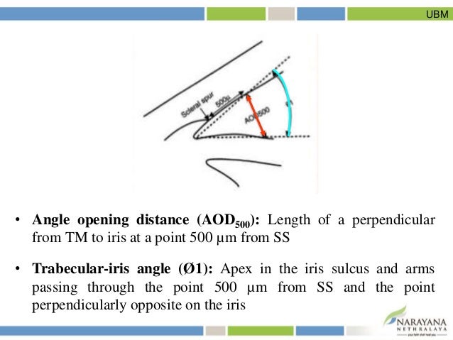 Assessment of Anterior Chamber Angle