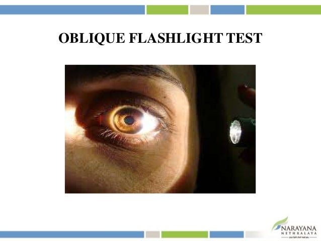 Assessment of Anterior Chamber Angle