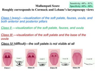 Assessment of airway | PPT