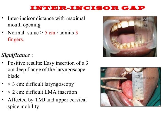 Assessment of airway