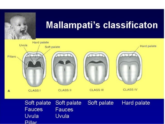 Assessment of airway