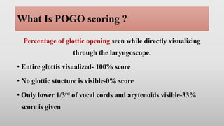 Assessment of airway | PPTX