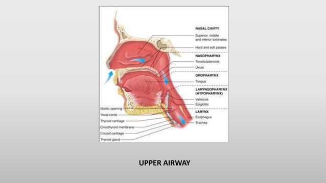 Assessment of airway | PPTX | Ear, Nose and Throat Conditions ...