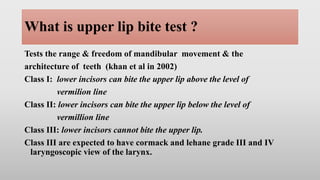 Assessment of airway | PPTX