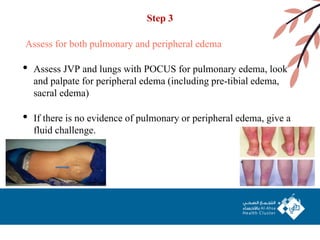ASSESSMENT OF AKI IN ER.pptx
