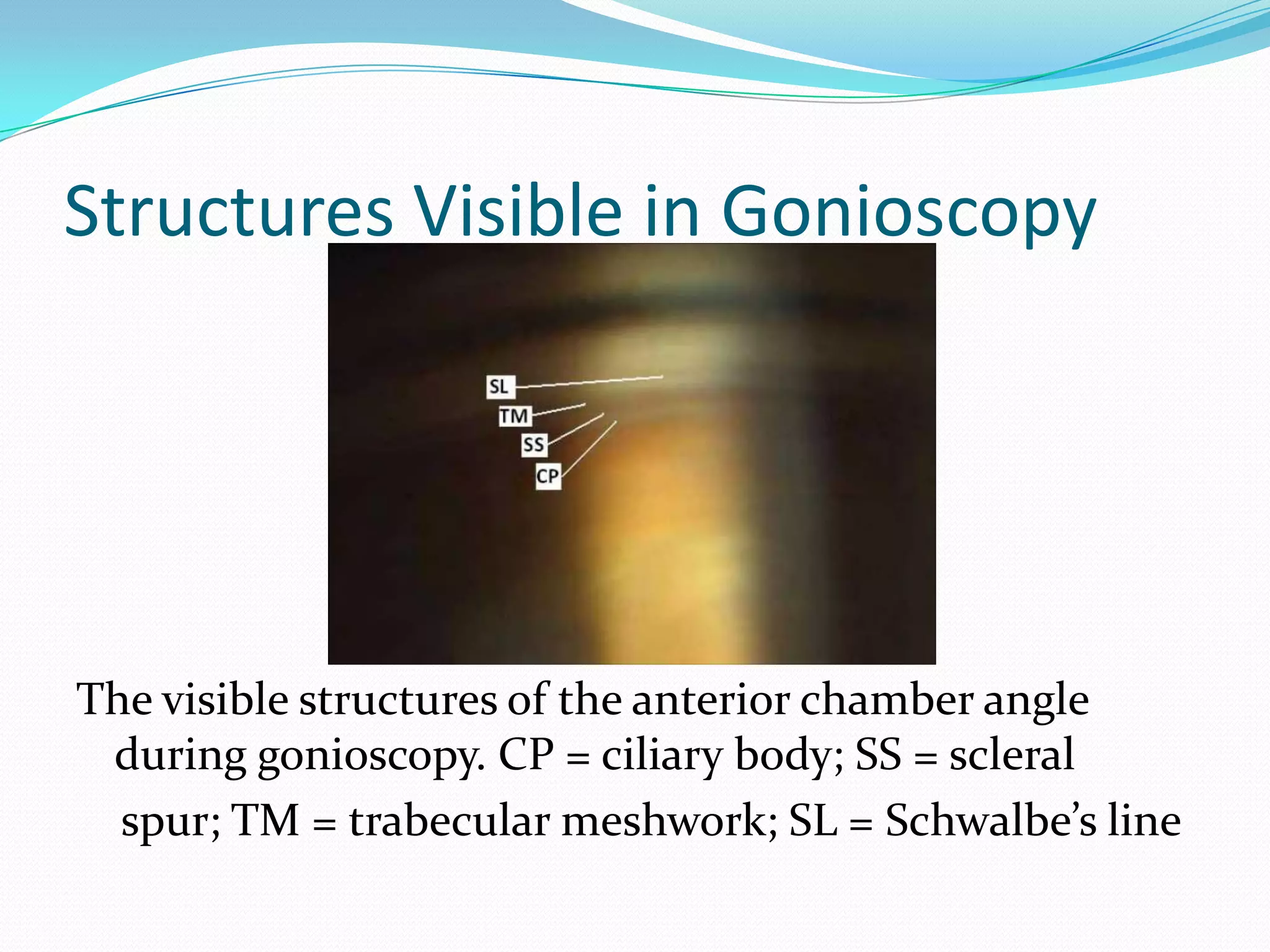 Assessment of anterior chamber | PPTX