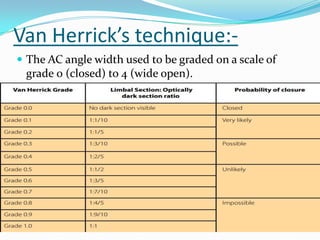 Assessment of anterior chamber | PPTX