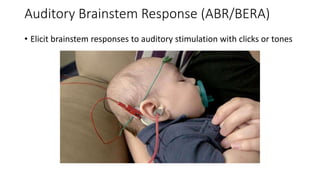 ASSESSMENT OF AUDITORY AND VESTIBULAR DYSFUNCTION.pptx