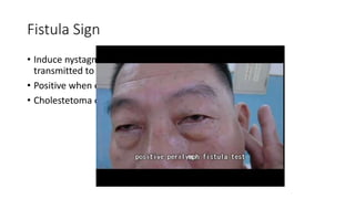 ASSESSMENT OF AUDITORY AND VESTIBULAR DYSFUNCTION.pptx