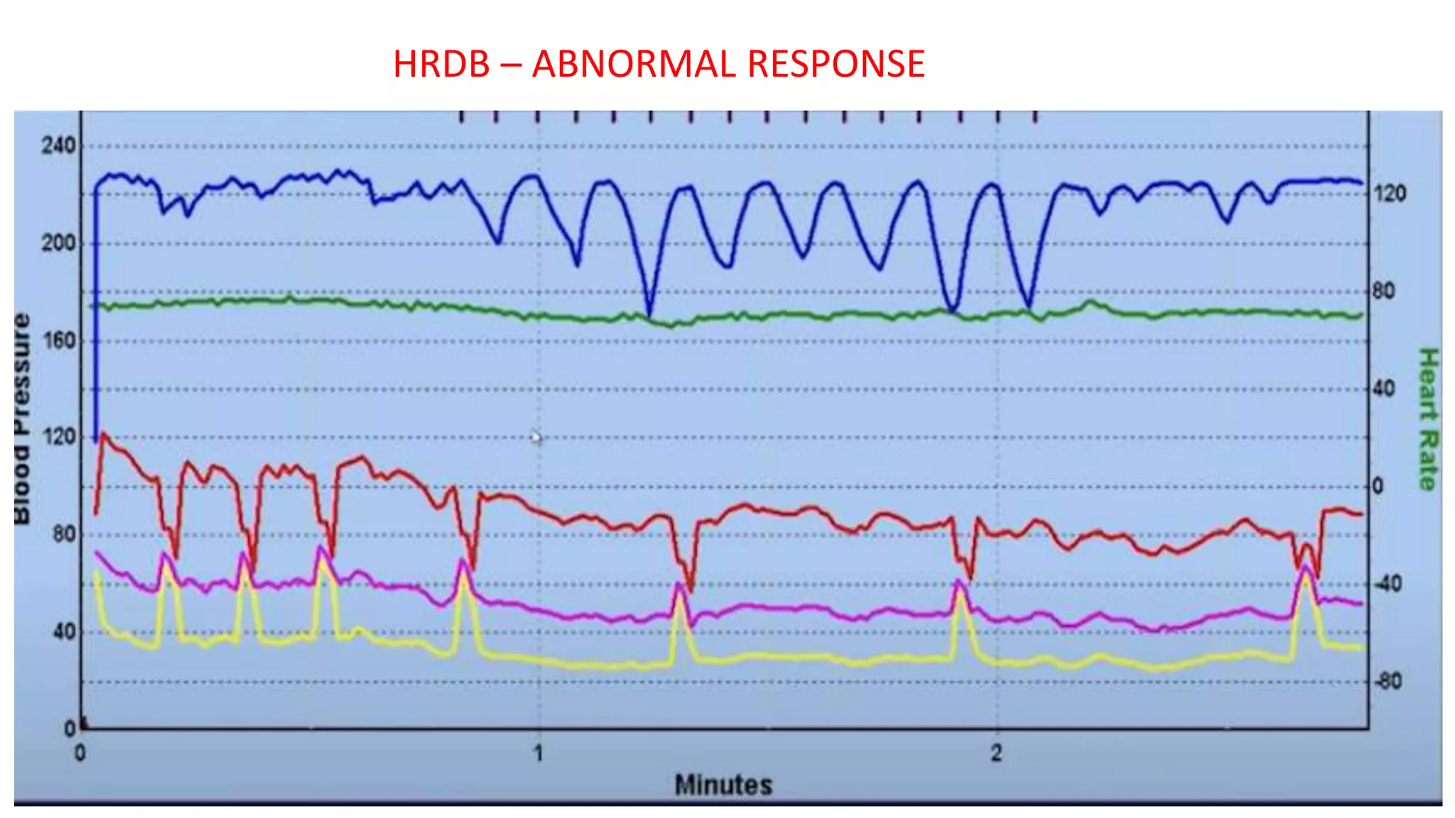 Assessment Of Autonomic Function Test Pptx