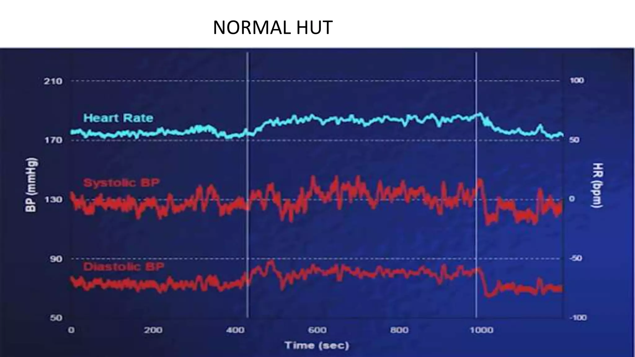 Assessment Of Autonomic Function Test Pptx