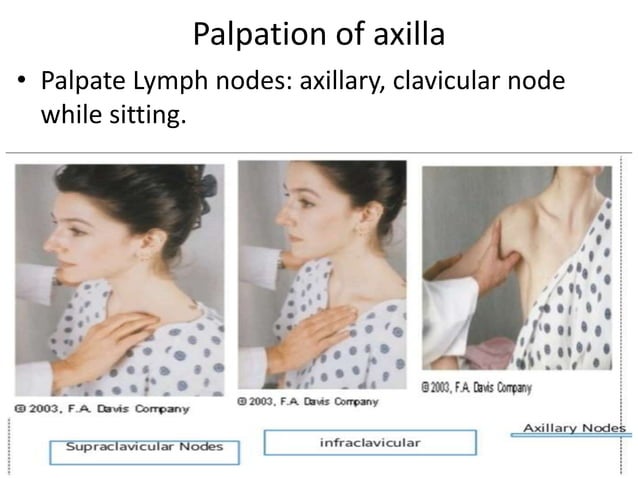 Assessment of Breast and Axiila .pptx | Reproductive Health | Diseases ...