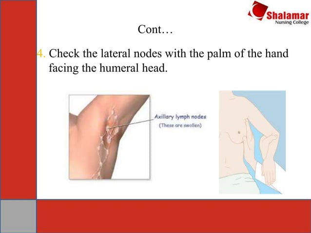 Assessment Of Breast Axila And Genitalia Ppt