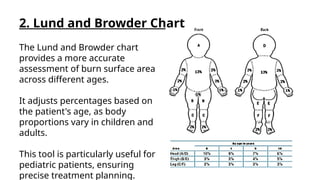 Assessment Of Burn (1).pptx assessment of burn | PPT