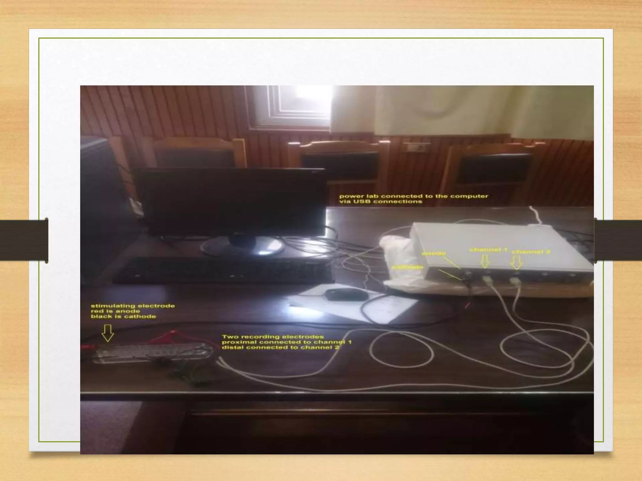 Assessment of cardiac contractility using langendorff apparatus connected to a powerlab | PPTX