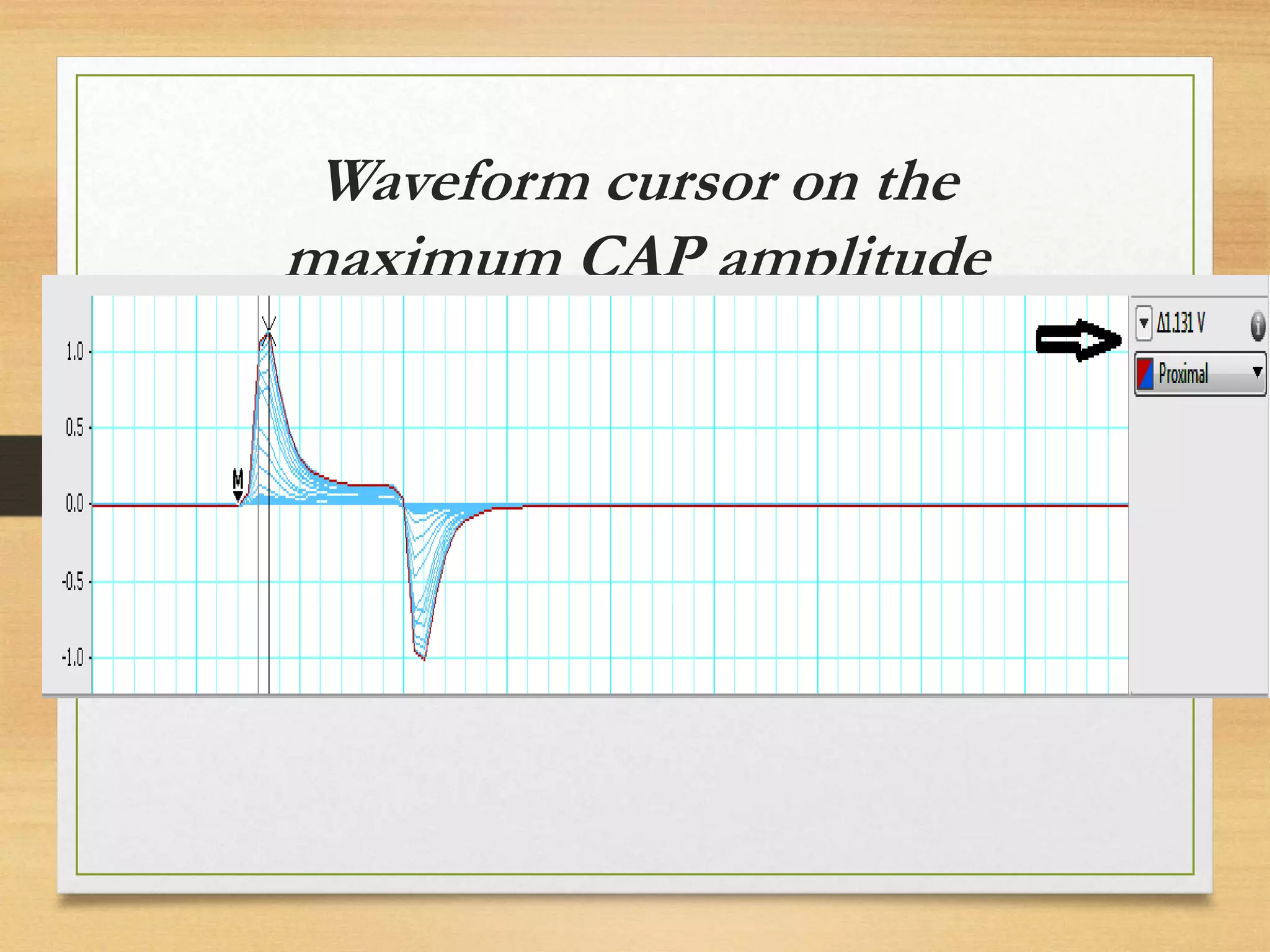 Assessment of cardiac contractility using langendorff apparatus ...