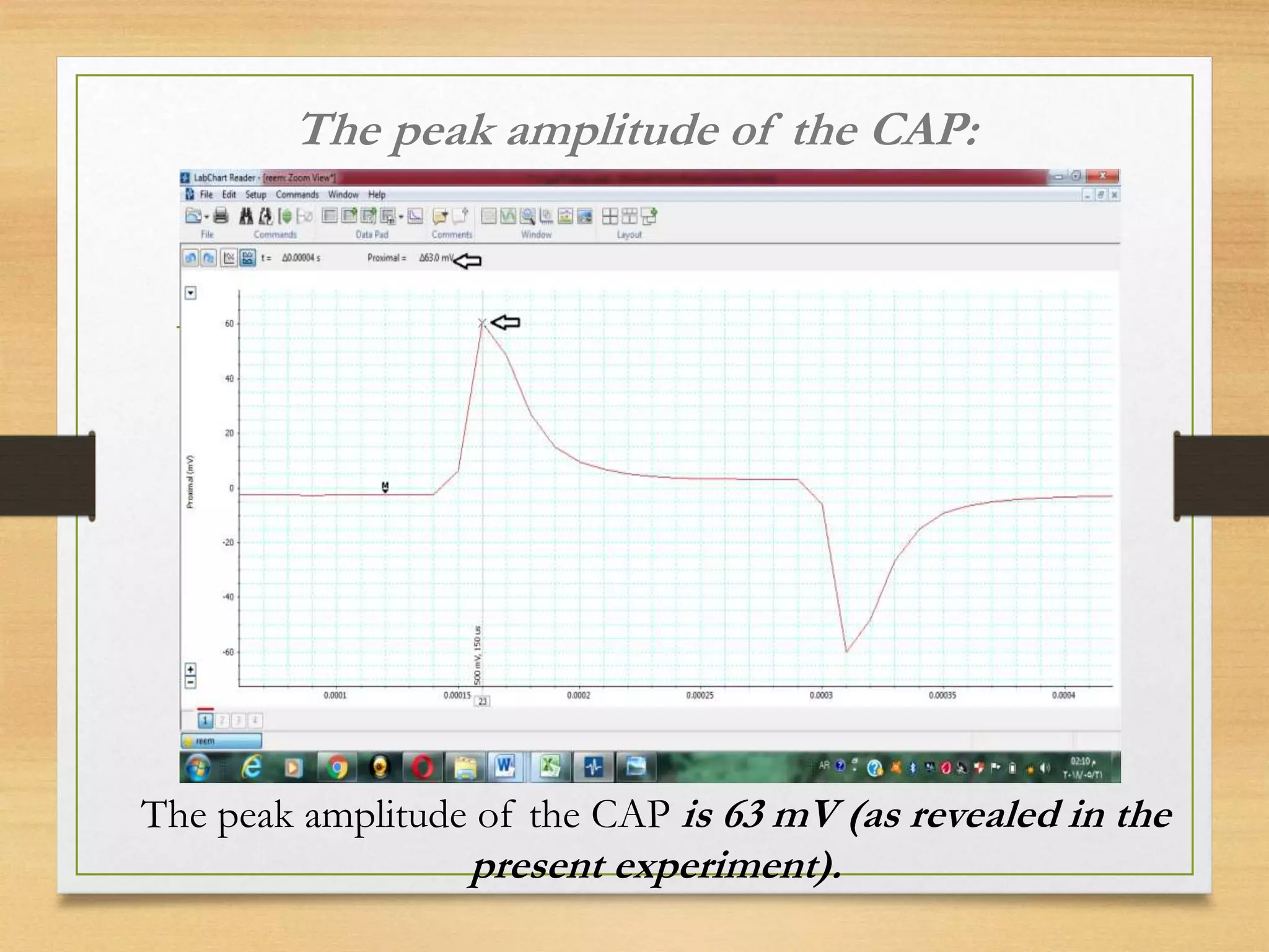 Assessment of cardiac contractility using langendorff apparatus connected to a powerlab | PPTX