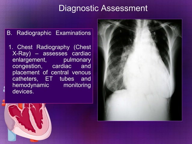 Assessment Of Cardiovascular Function | PPT | Heart and Cardiovascular ...