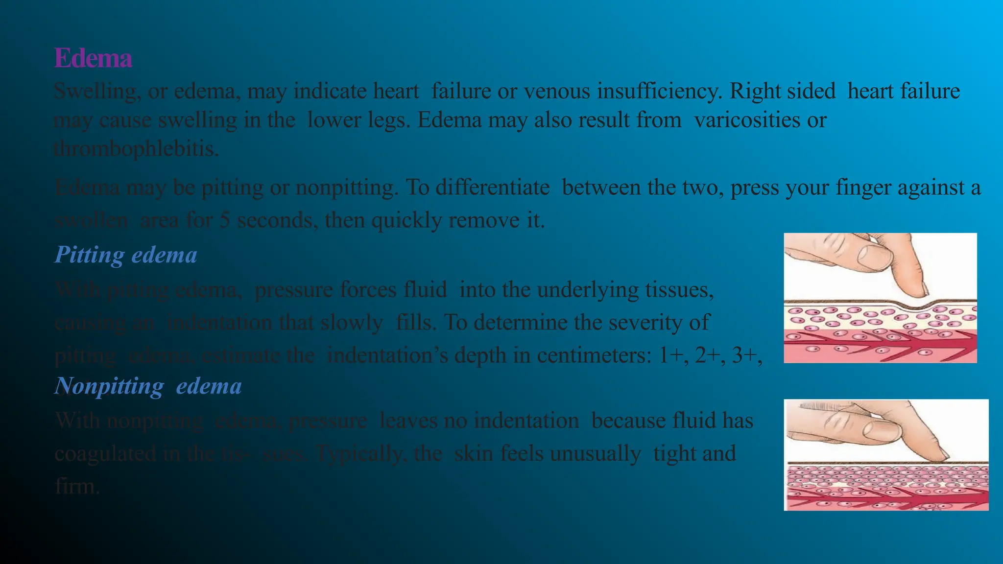 Assessment of Caridovascular sys.pptx Health assessment | PPTX