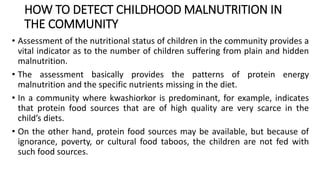 ASSESSMENT OF CHILD’S NUTRITION.pptx
