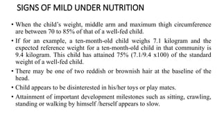 ASSESSMENT OF CHILD’S NUTRITION.pptx