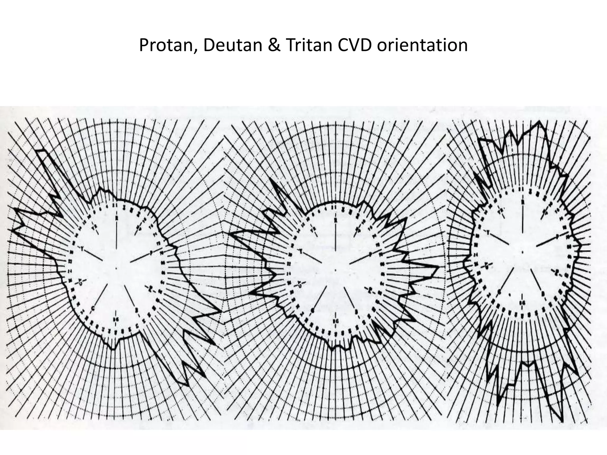 Assessment of color vision | PPT