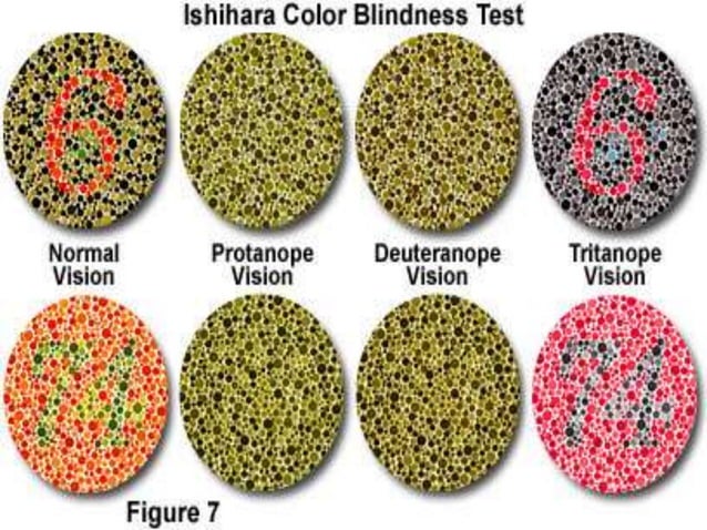 Assessment of color vision | PPT