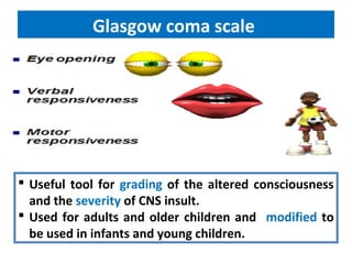Assessment of consciousness | PPS