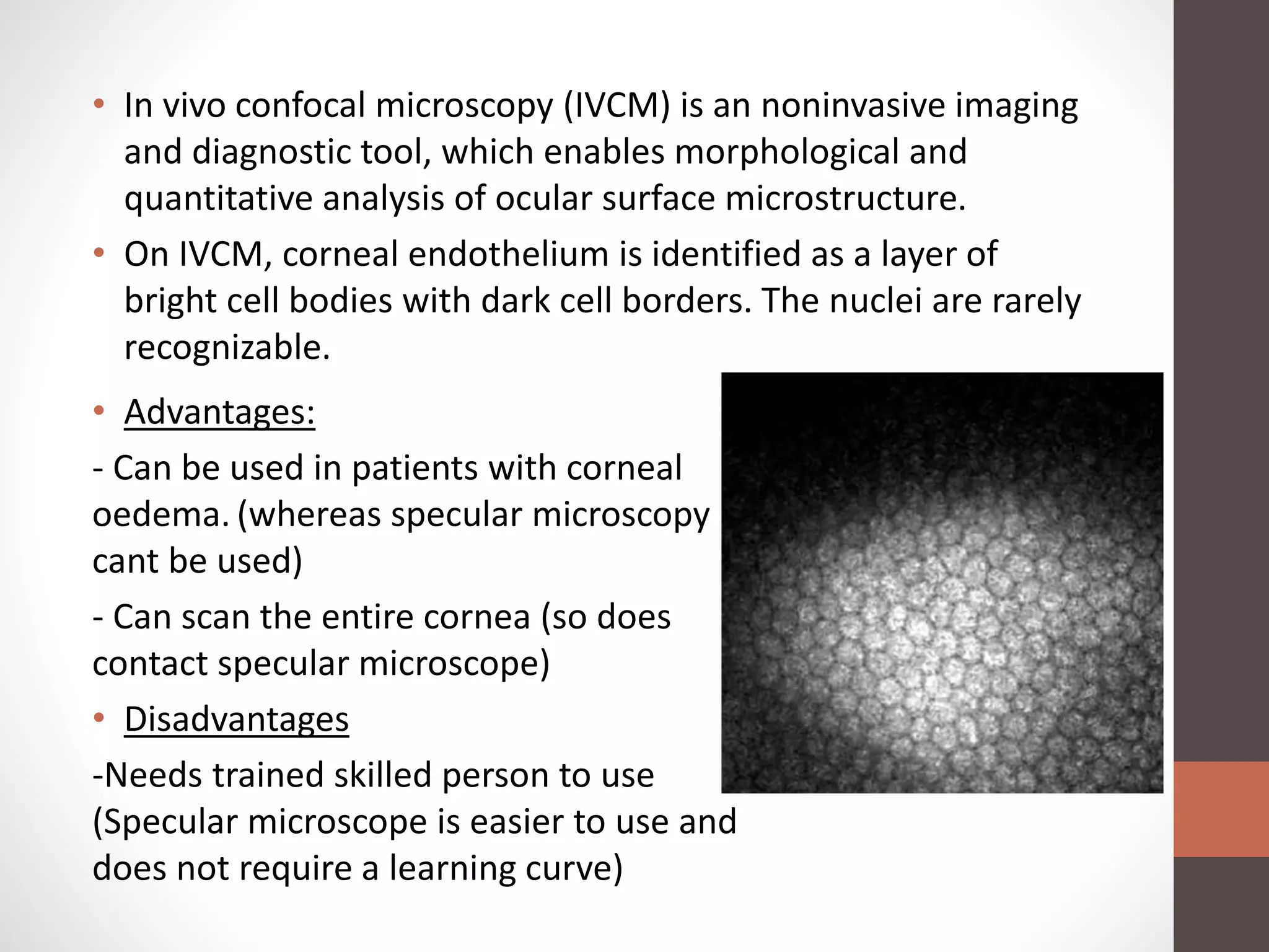 Assessment of corneal endothelium | PPTX