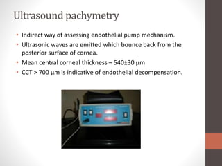 Assessment of corneal endothelium | PPTX