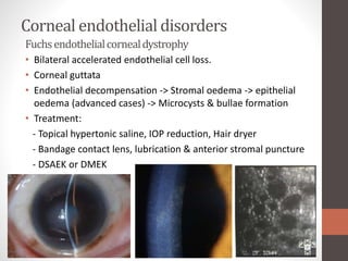 Assessment of corneal endothelium | PPTX