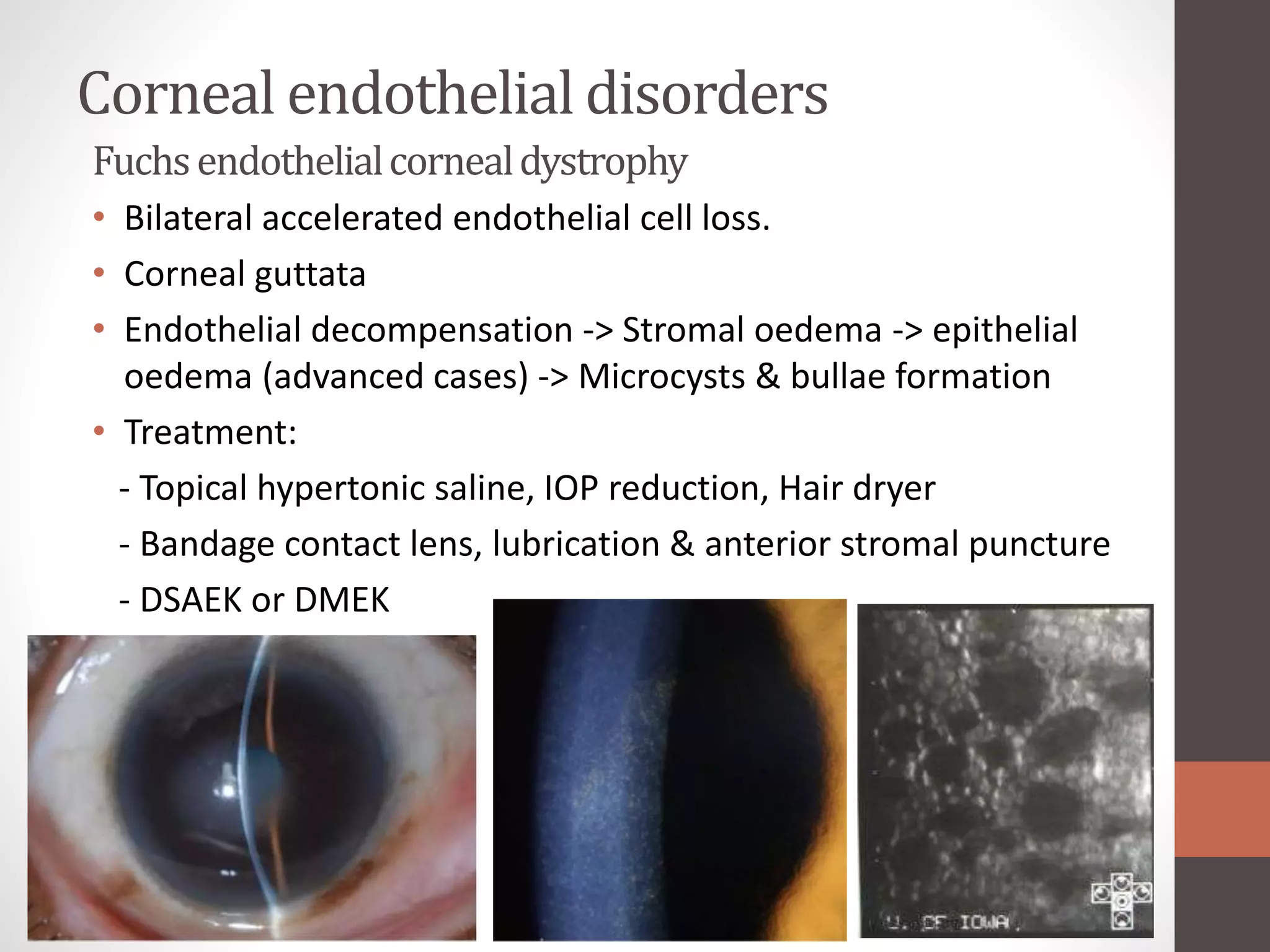 Assessment of corneal endothelium | PPTX
