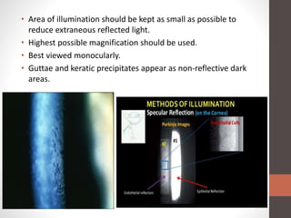 Specular Reflection Cornea