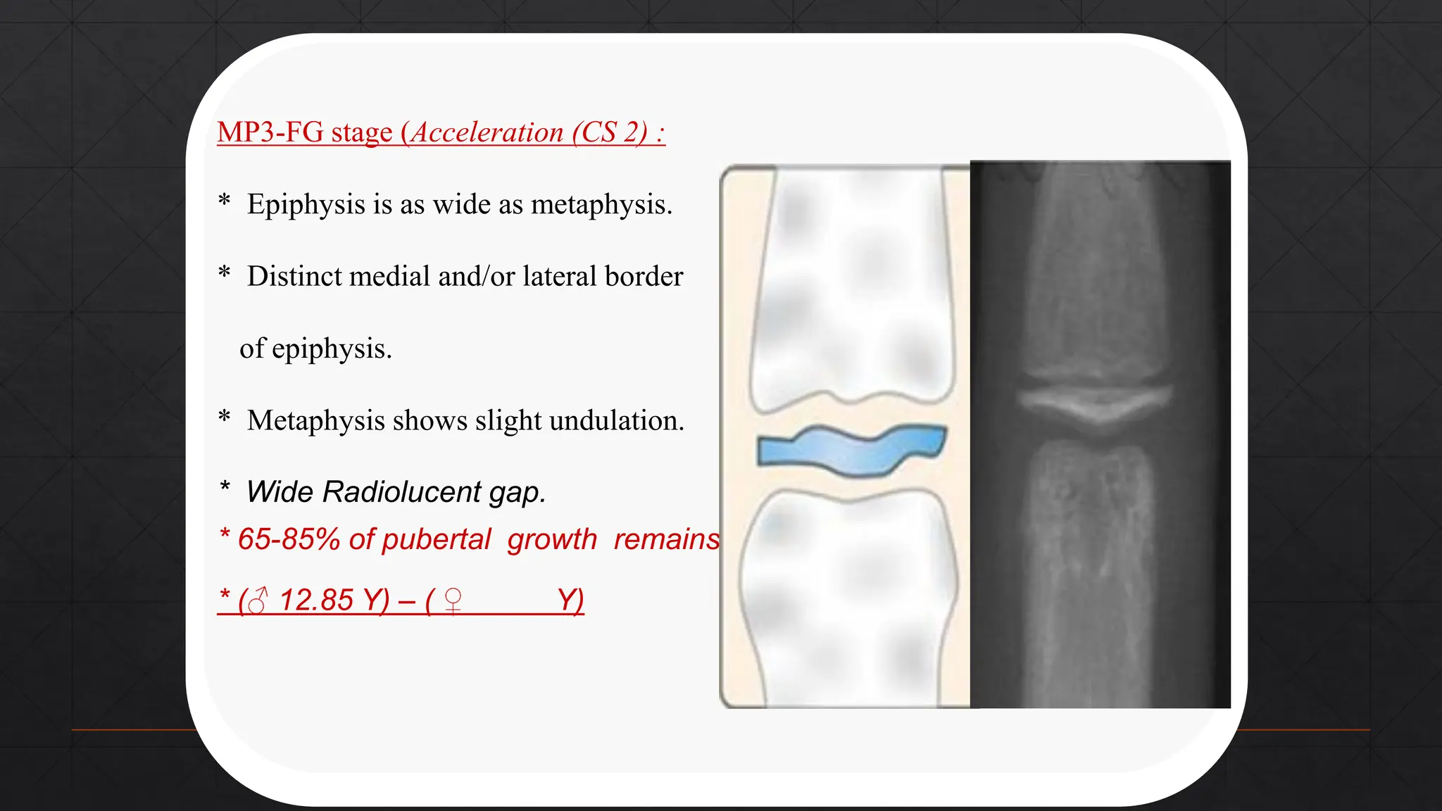 Assessment of Developmental Age ortho .pdf