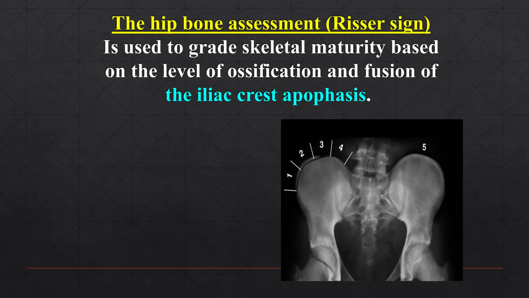 Assessment of Developmental Age ortho .pdf