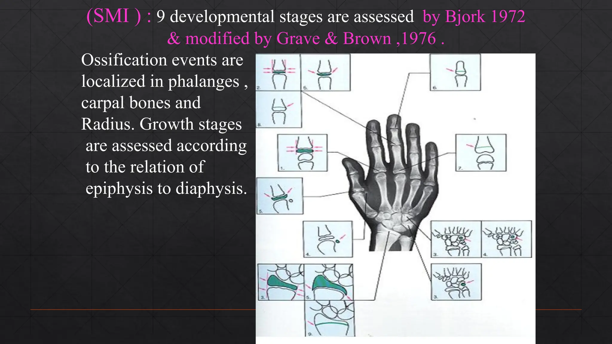Assessment of Developmental Age ortho .pdf