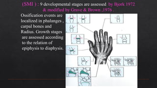 Assessment of Developmental Age ortho .pdf