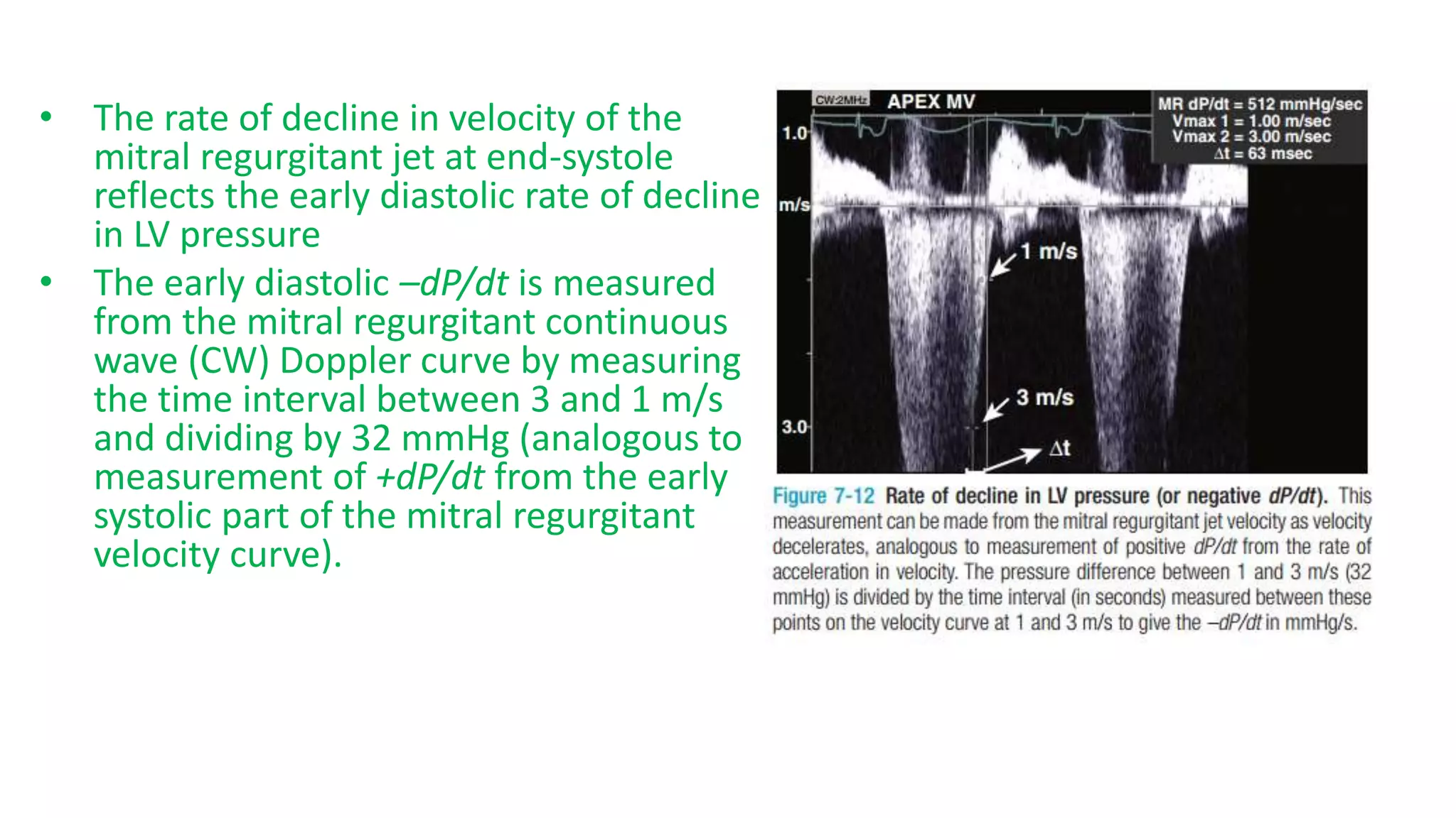 Assessment of diastolic function by echo | PPTX