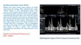 Assessment of diastolic function by echo | PPTX