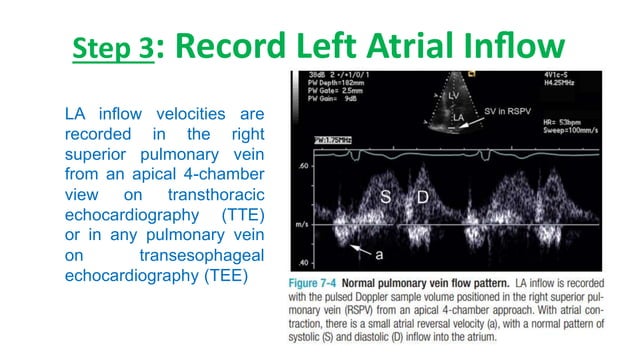 Assessment of diastolic function by echo | PPTX