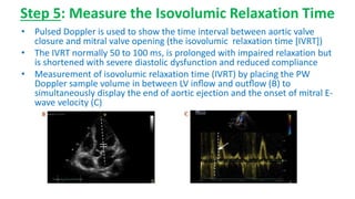 Assessment of diastolic function by echo | PPTX