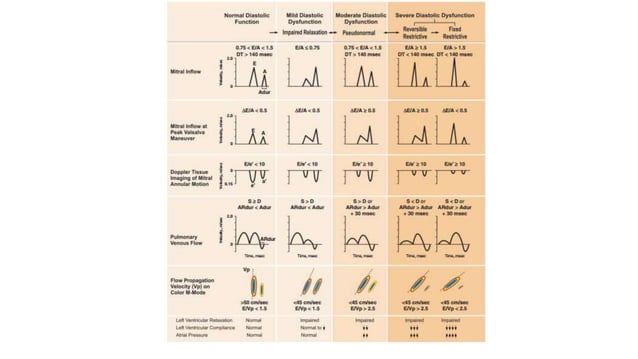 Assessment of diastolic function by echo | PPTX