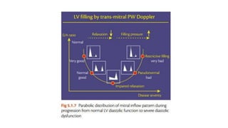 Assessment of diastolic function by echo | PPTX