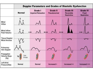 ASSESSMENT OF DIASTOLIC FUNCTION. .pptx