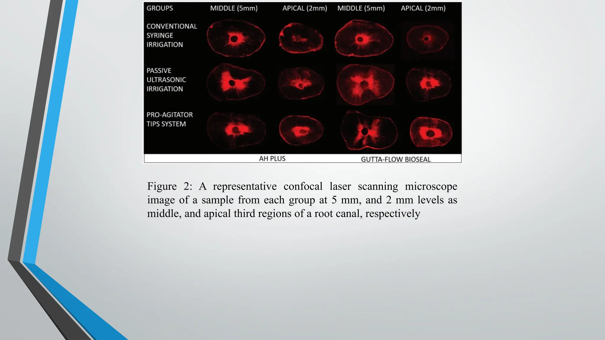 Assessment of different irrigation techniques on the penetration.pptx