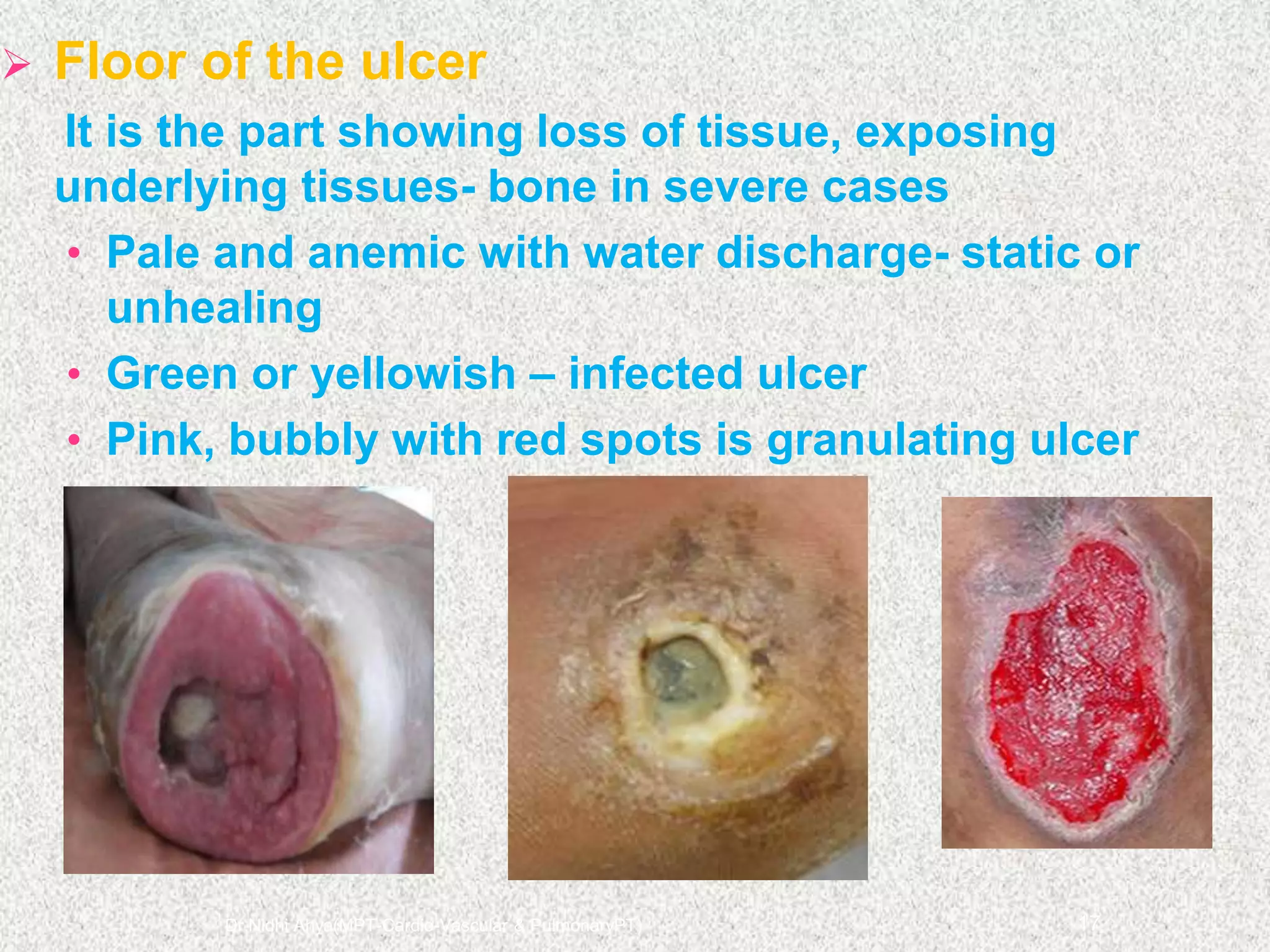 Assessment of DM and diabetic foot | PPTX