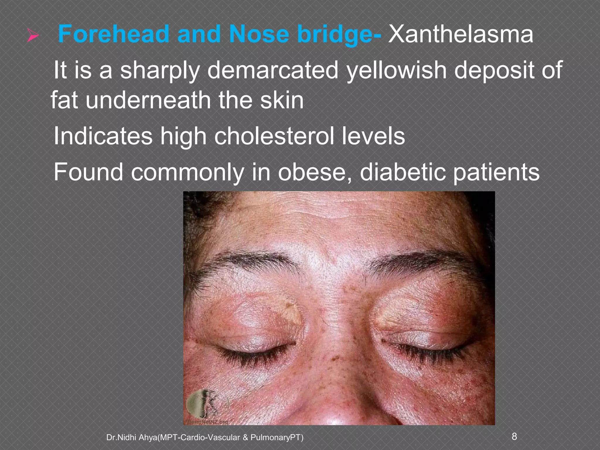Assessment of DM and diabetic foot | PPTX