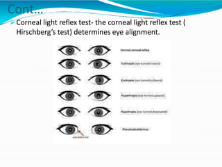 Assessment of eye.pptx