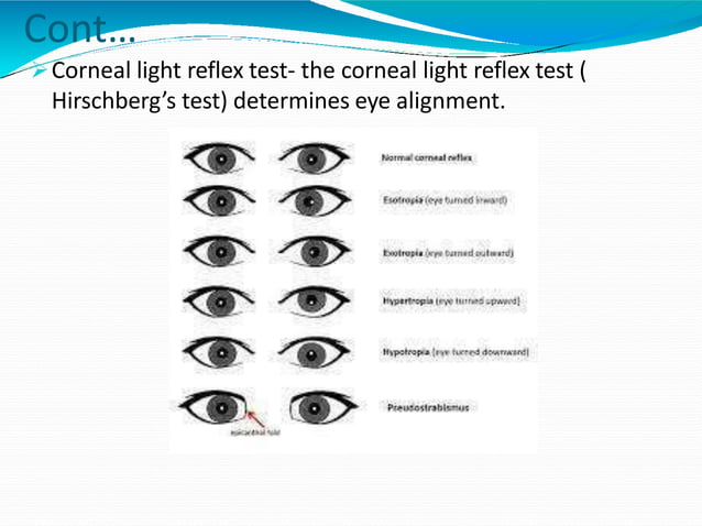 Assessment of eye.pptx